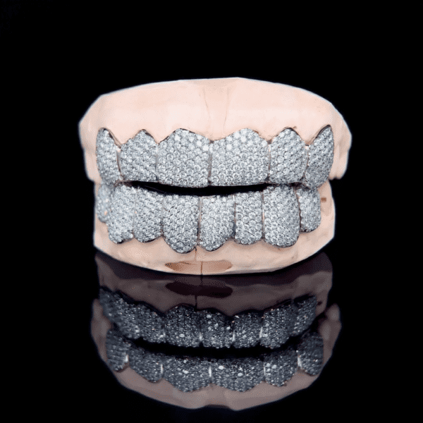 Custom Gold Grillz UK | Diamond Teeth Jewelry | Kabils Grillz Birmingham