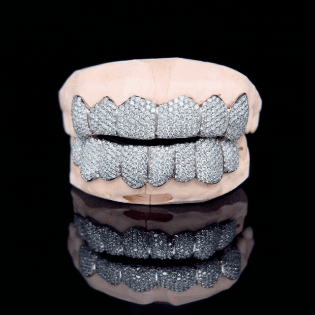 Custom Diamond Grillz | VVS Iced Out Teeth | Kabils Grillz